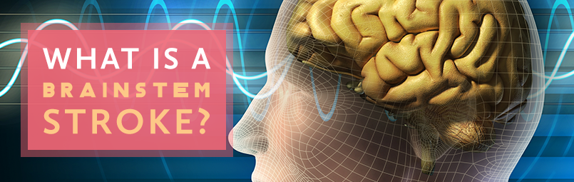 What is a Brainstem Stroke? – Saebo